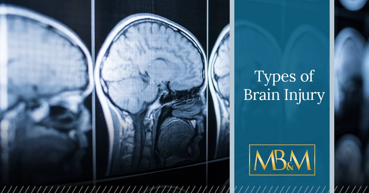 What Are the Types of Brain Injury? | MBM Justice | Providence