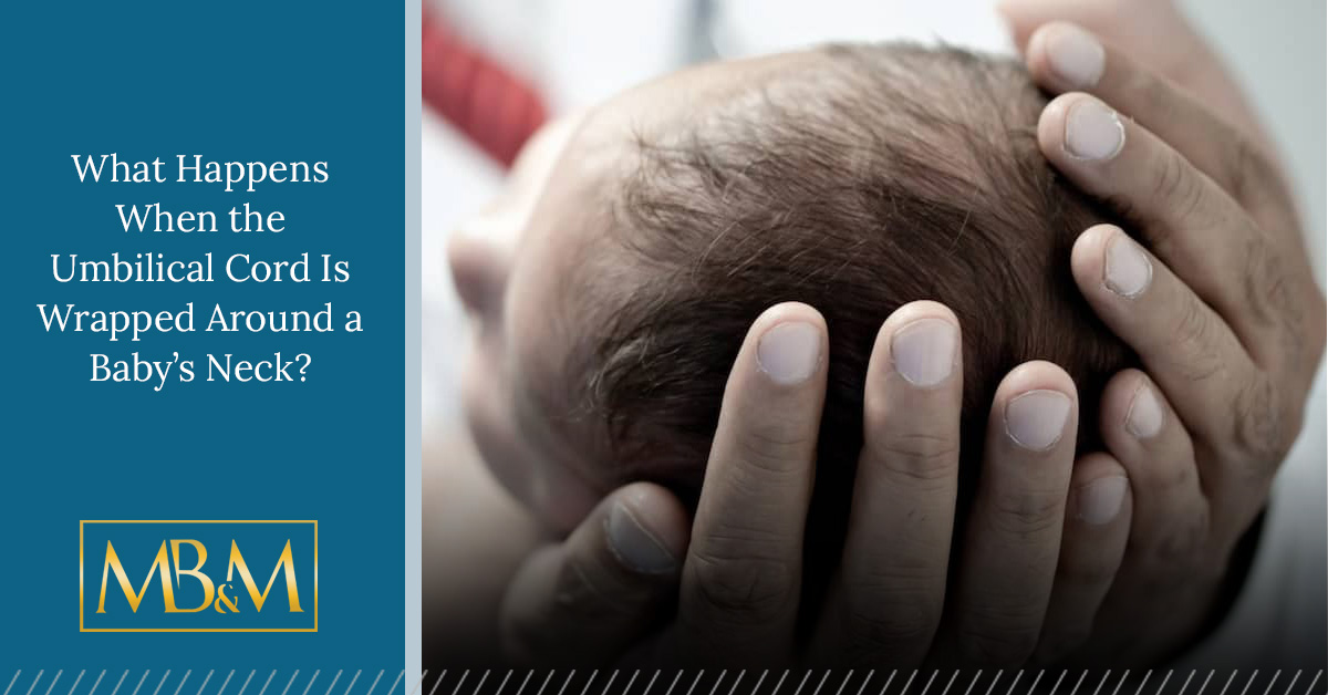 What If the Umbilical Cord Is Wrapped Around a Baby's Neck? | RI