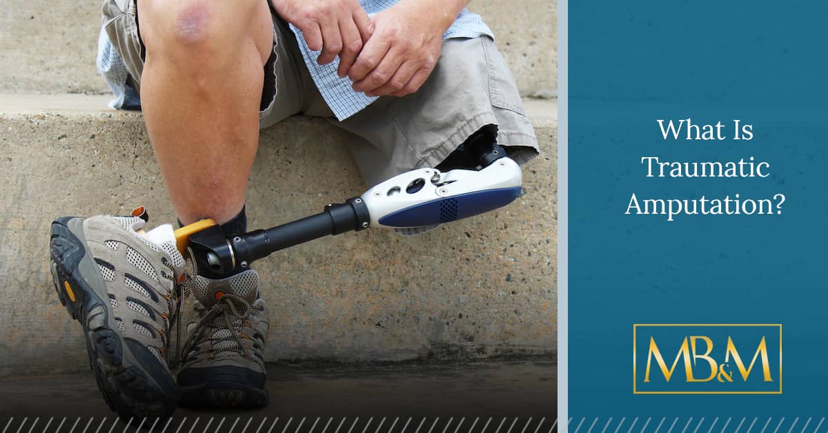 When Is an Amputation Considered Traumatic? | Providence, RI