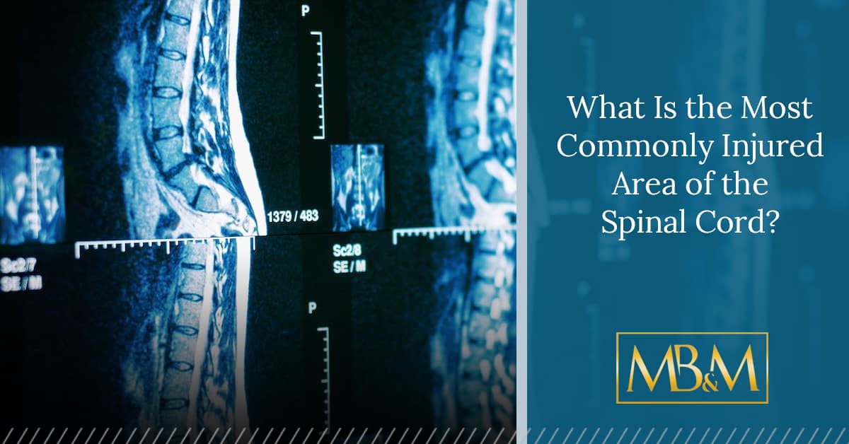 What Are the Most Common Spinal Cord Injuries? | Providence