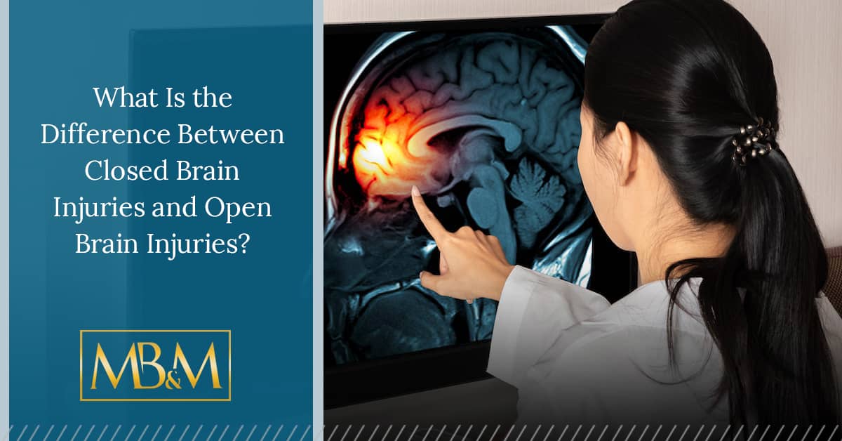 How Do Closed and Open Brain Injuries Differ? | Providence