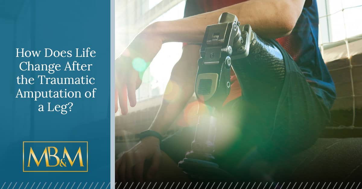 What Are the Long-Term Effects of Amputation? | Providence