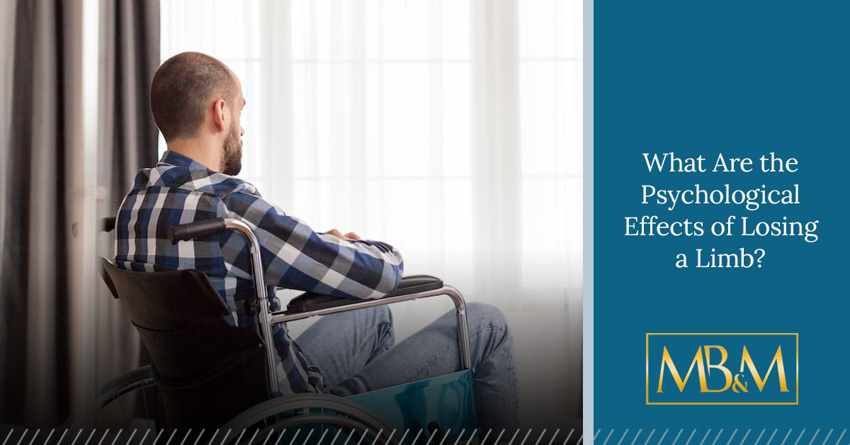 The Psychological Effects of Losing a Limb | Amputation Lawyers