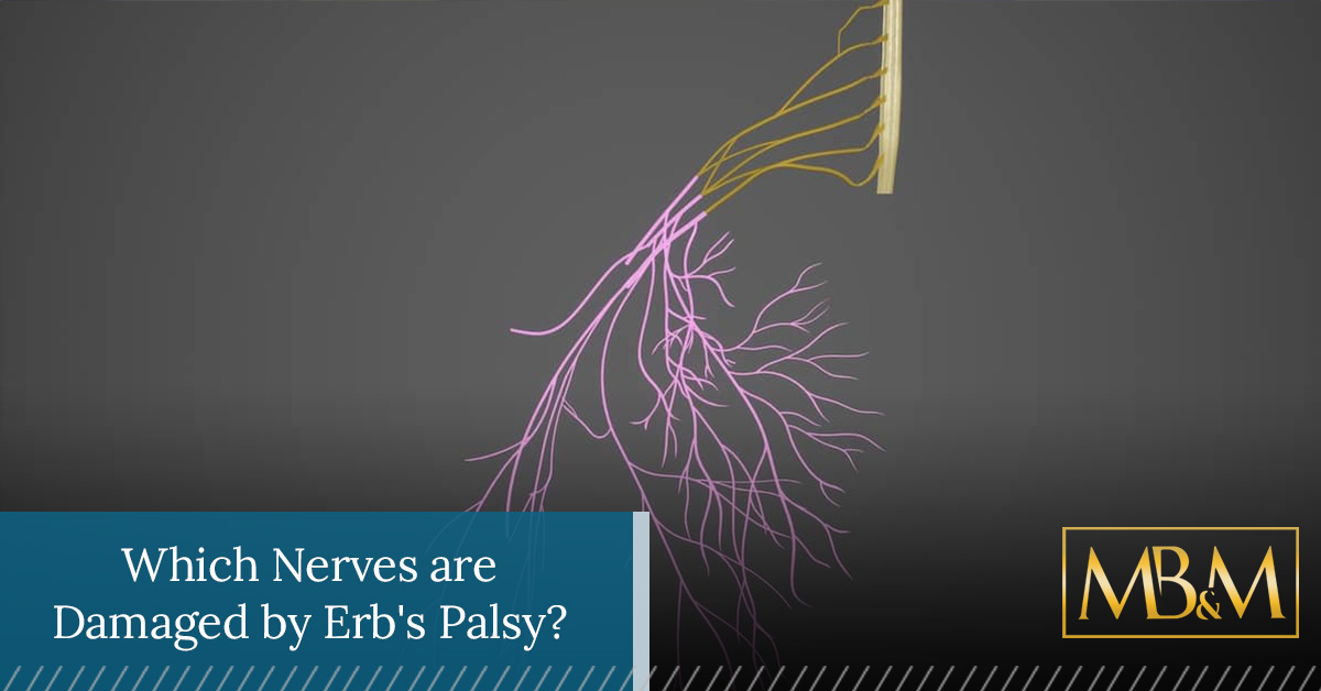 Which Nerves Are Damaged by Erb's Palsy?