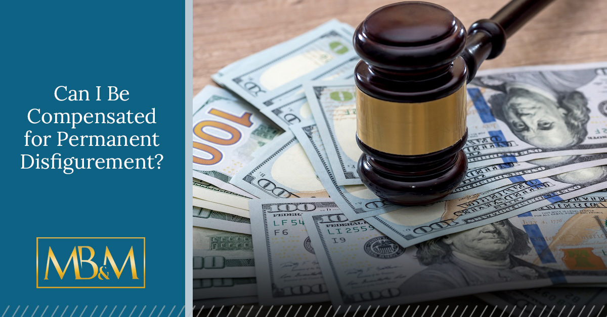 Compensation for Disfigurement in Rhode Island