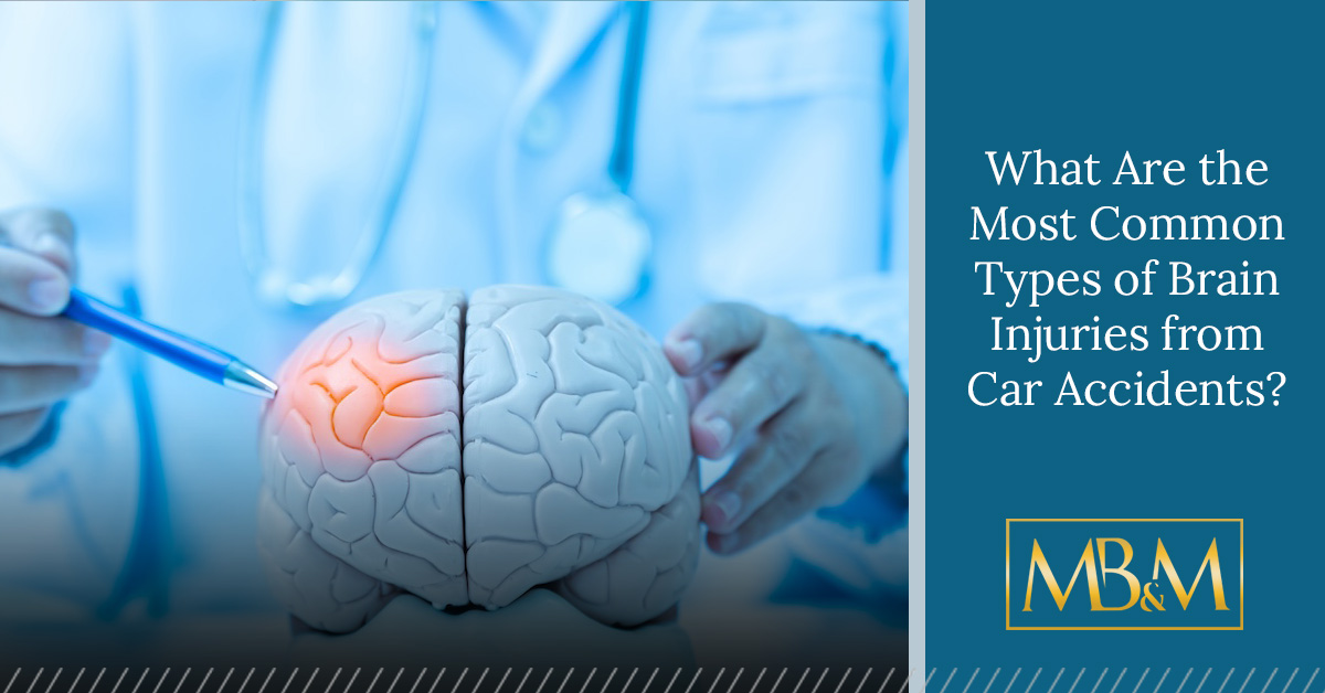 Car Accidents & Common Types of Brain Injuries